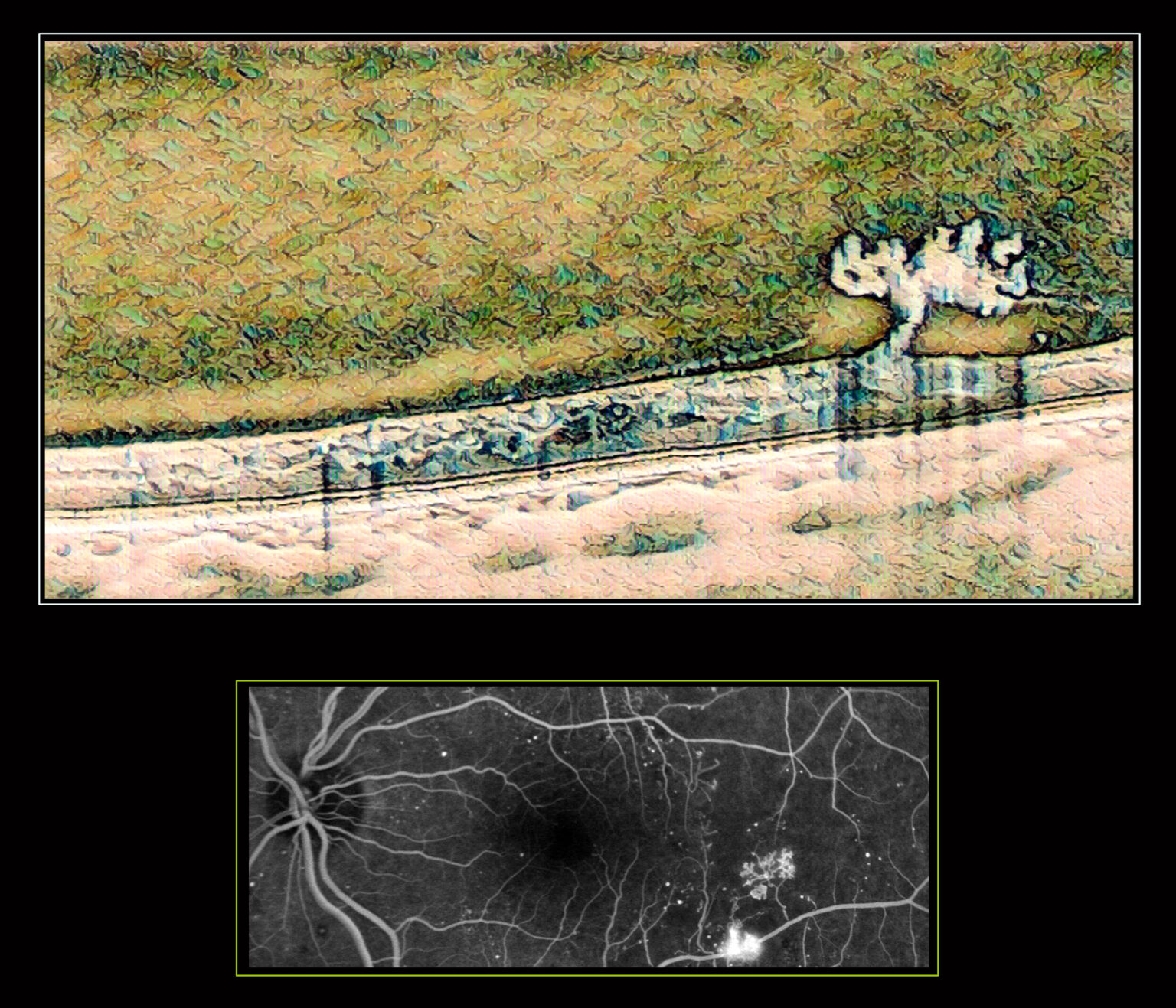Imaging at EMG - Eyecare Medical Group