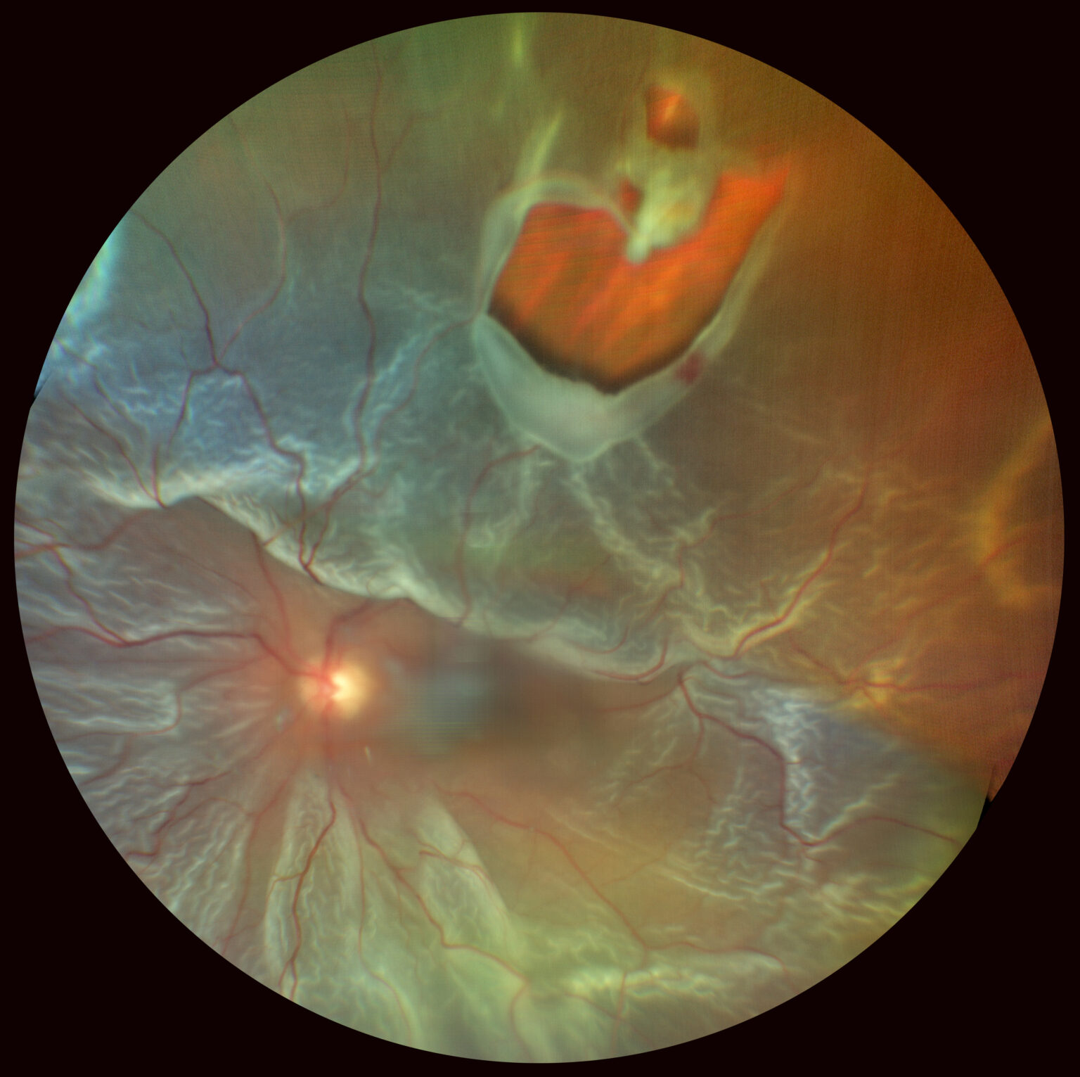 Imaging at EMG - Eyecare Medical Group